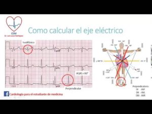 La Guía Definitiva del Complejo QRS en ECG | TODO CALCULADORAS